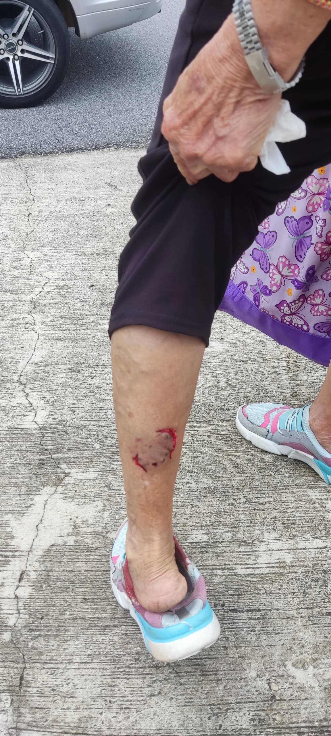 Bila orang kena gigit anjing, di mana NGO pencinta haiwan? – Negeri Kita