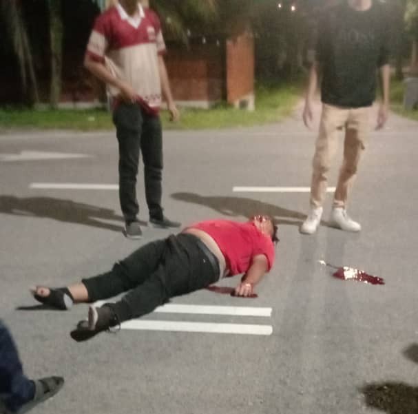 Bila orang kena gigit anjing, di mana NGO pencinta haiwan? – Negeri Kita